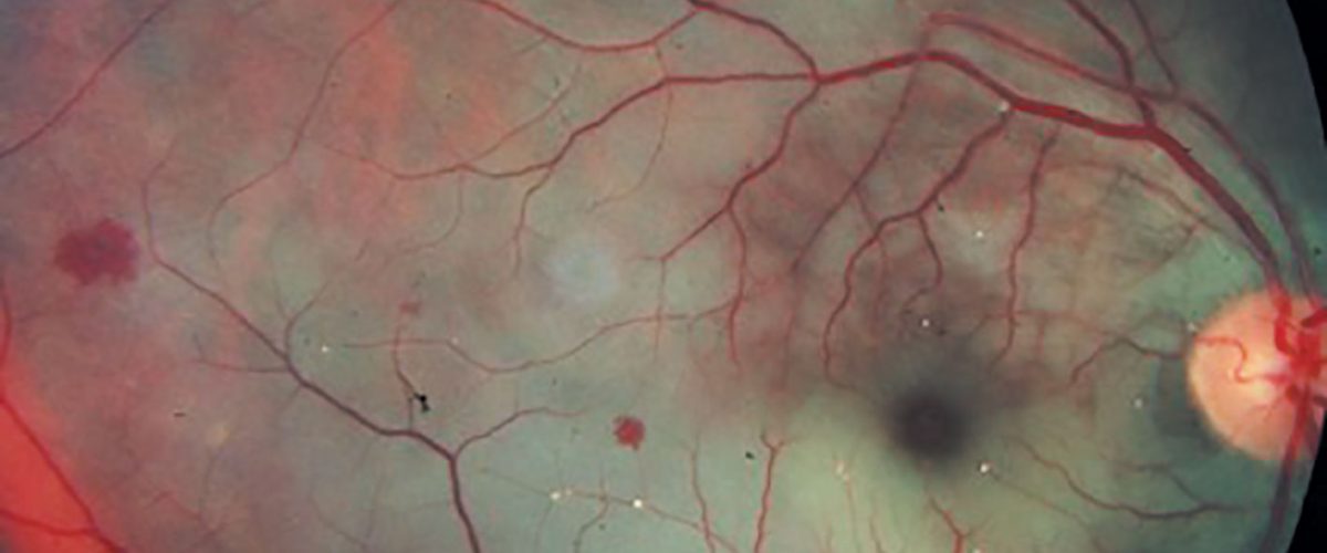 Neurologies.fr - Actualités scientifiques en neurologie