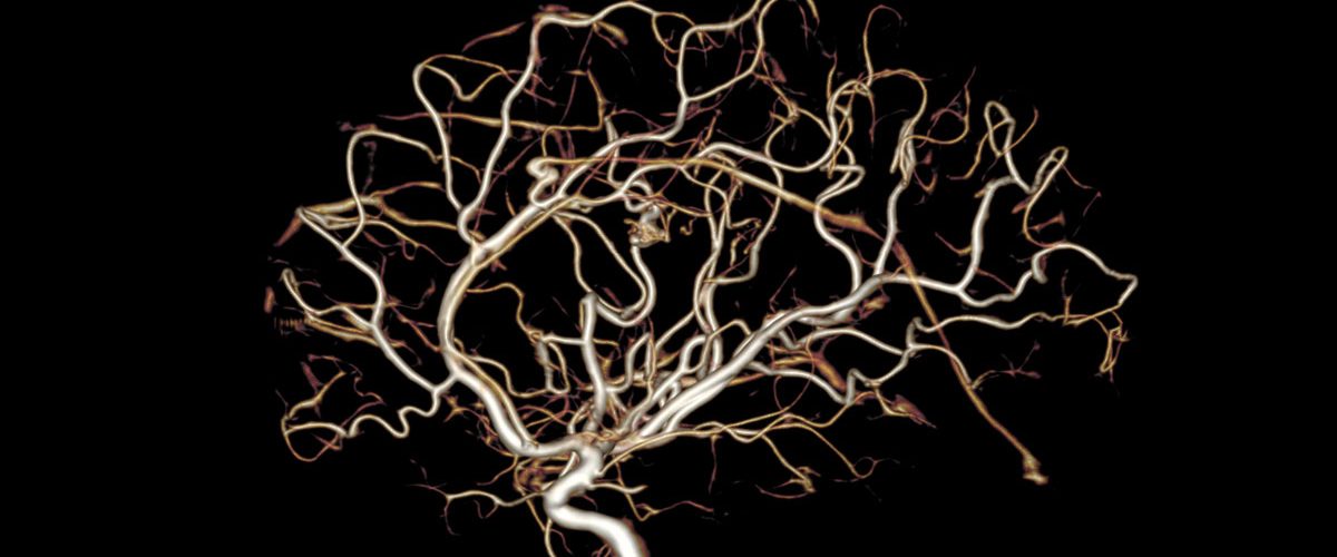 Neurologies.fr - Actualités scientifiques en neurologie