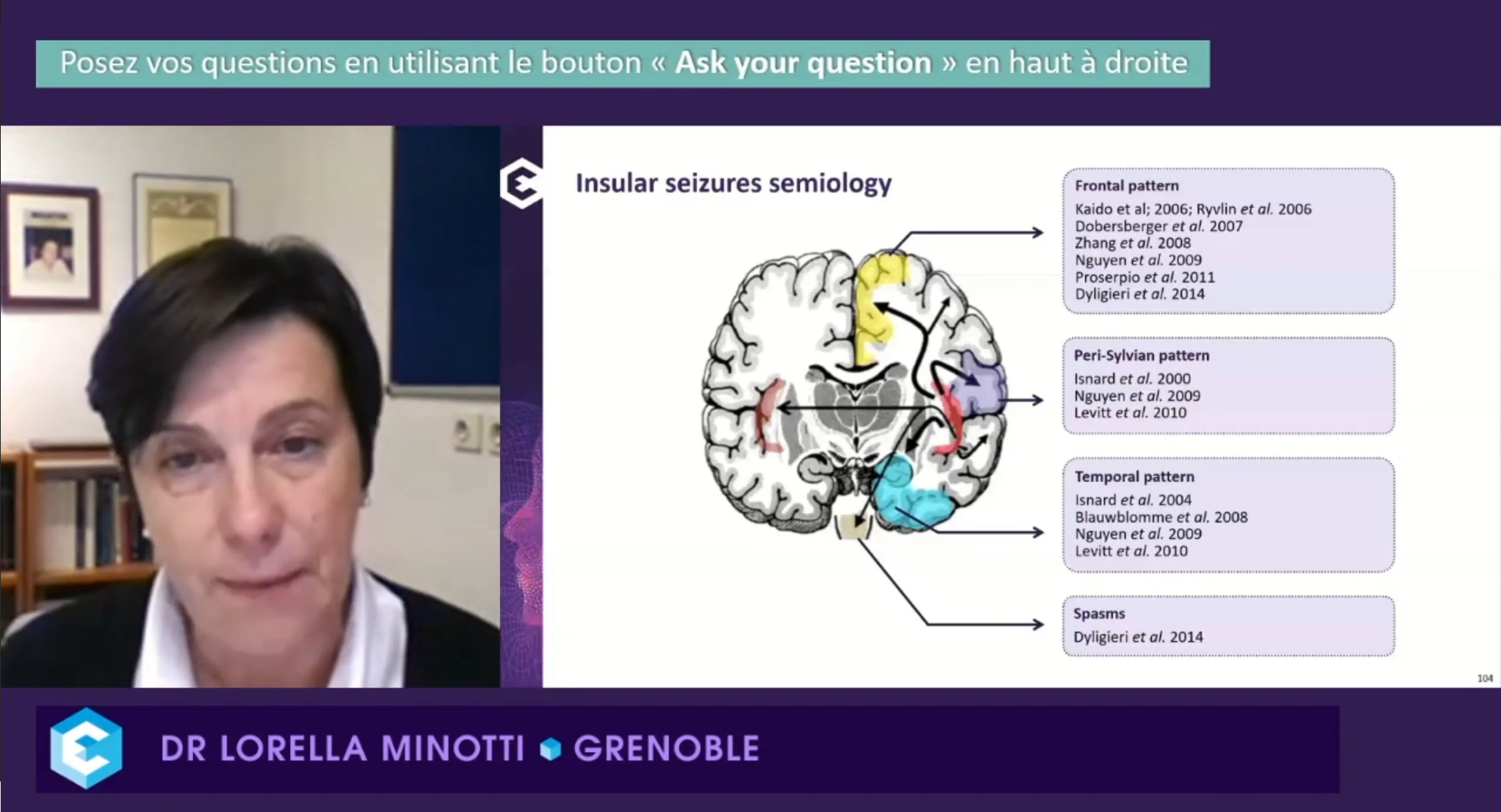 Actualités scientifiques - Neurologies